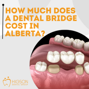 How Much Do Dental Bridges Cost in Alberta? - BEST Dental Bridge Cost ...